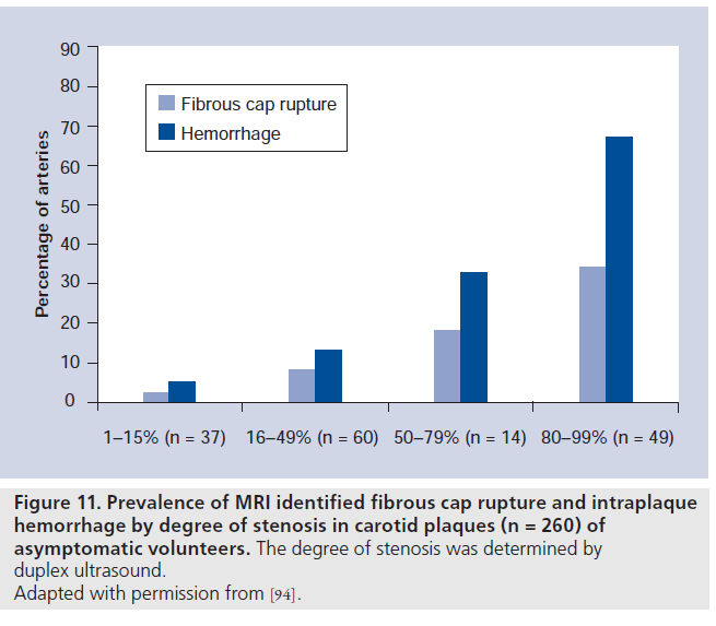 MRI in the early identification and classification of high-risk a