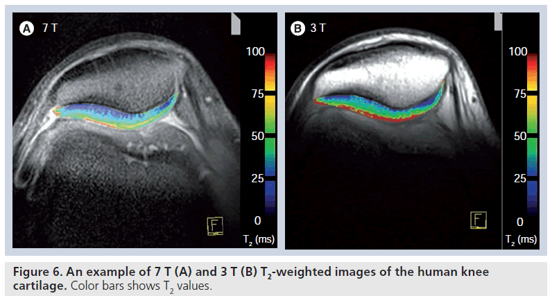 Advanced musculoskeletal MRI at ultra-high field (7 T)