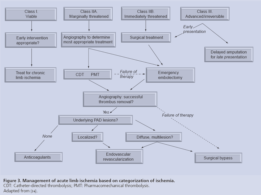 Choosing The Correct Therapeutic Option For Acute Limb Ischemia Choosing The Correct Therapeutic Option For Acute Limb Ischemia